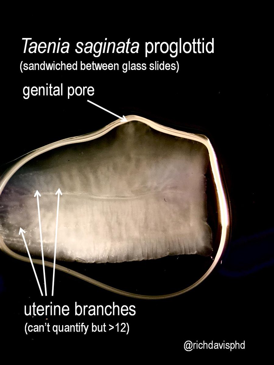 Taenia Saginata Proglottids