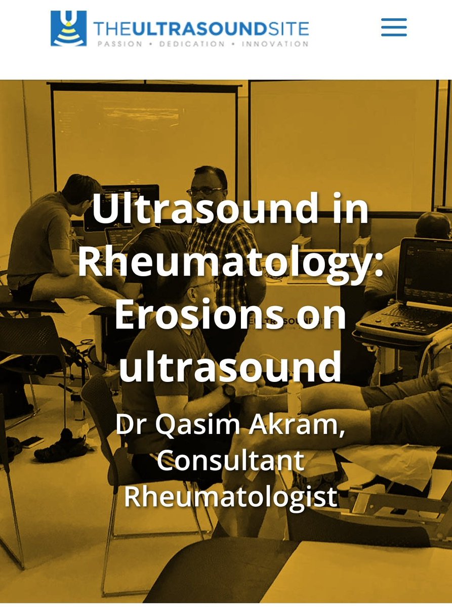 Common extensor tendon tear - The Ultrasound Site