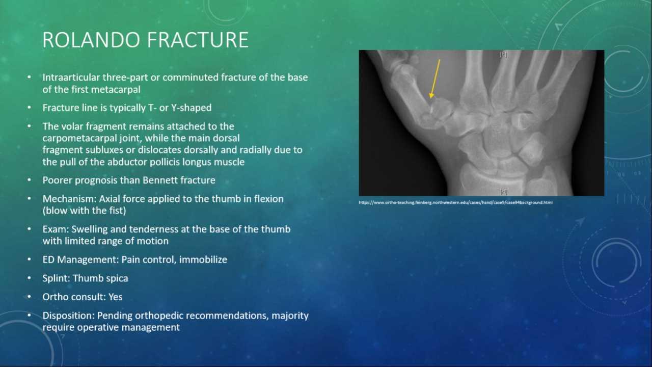 Rolando Fracture Thumb Fractures And Dislocations: Practice