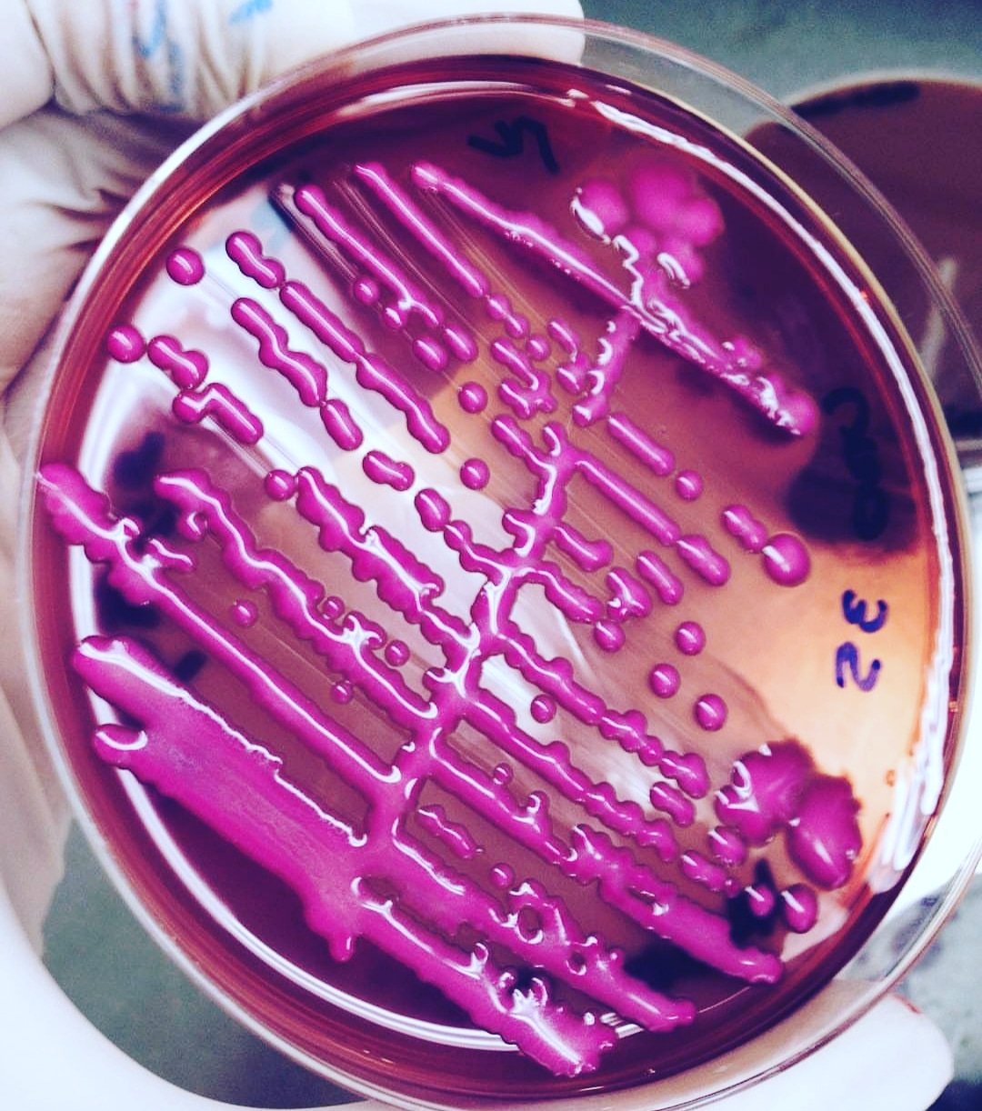 Klebsiella On Macconkey Agar