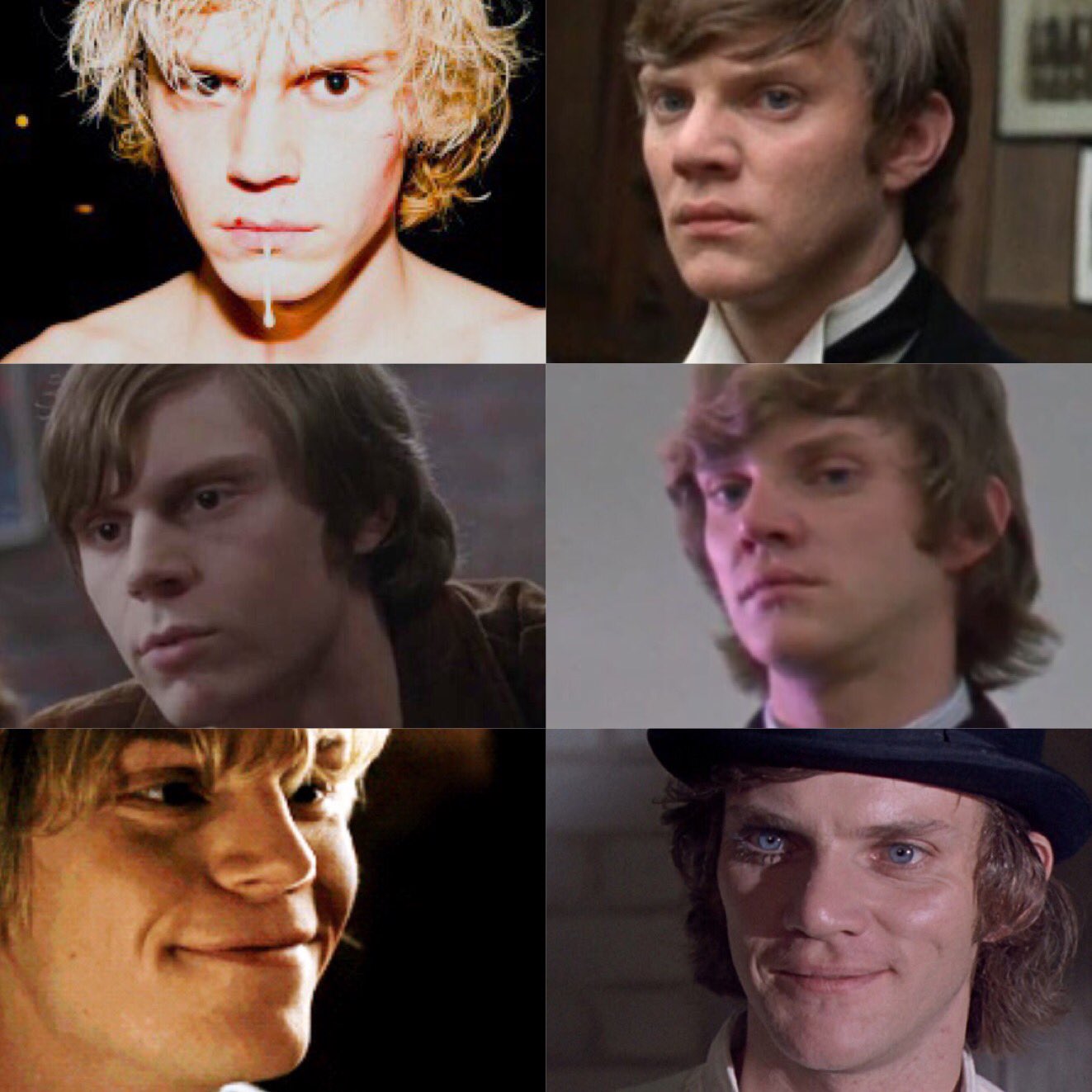 Young Malcolm Mcdowell Evan Peters A Clockwork Orange (2020's Version)