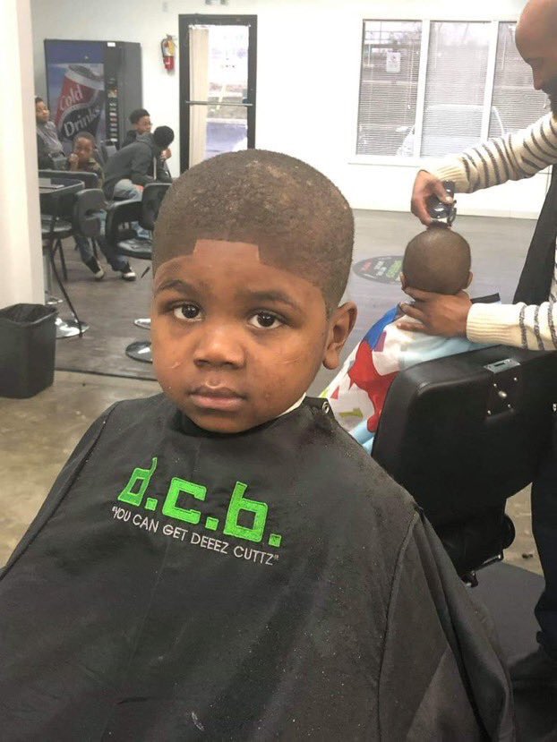 Paul George Messed Up Hairline