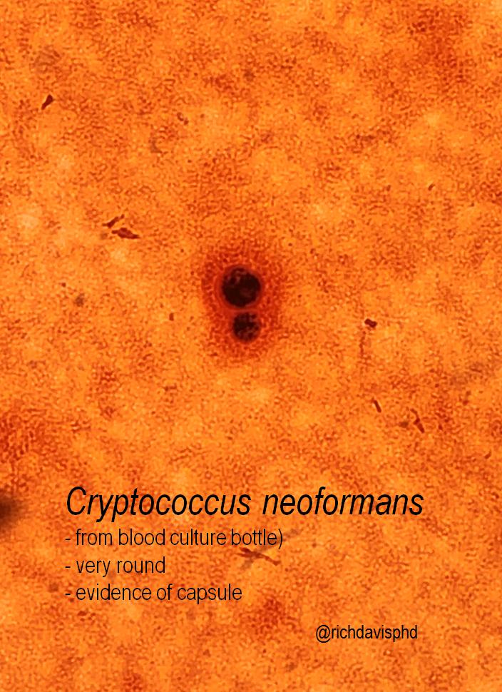Cryptococcus Neoformans Culture