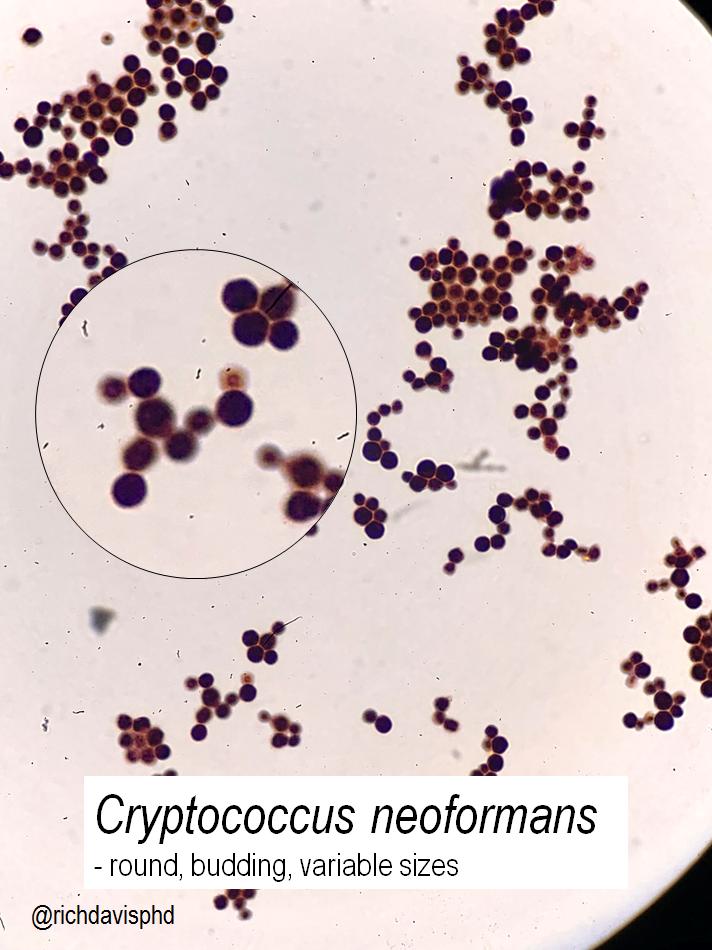 Cryptococcus Neoformans Gram Stain