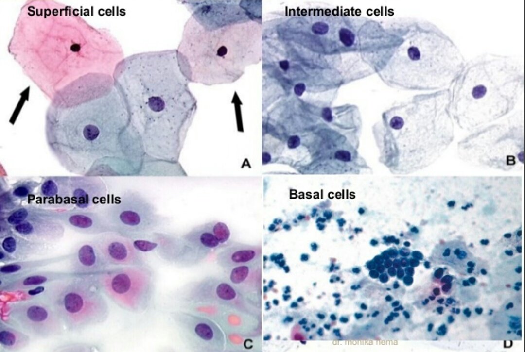 Squamous Epithelial Cells Under Microscope