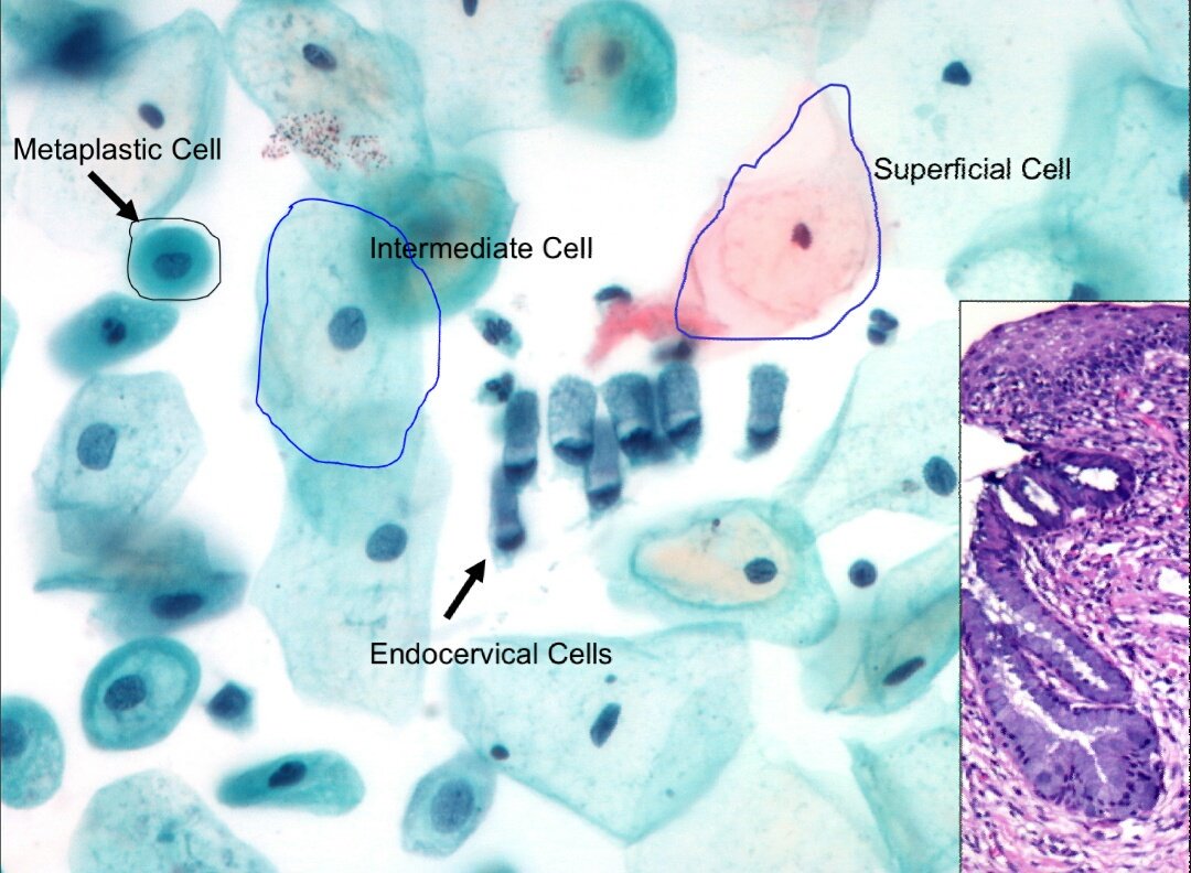 Intermediate Cells