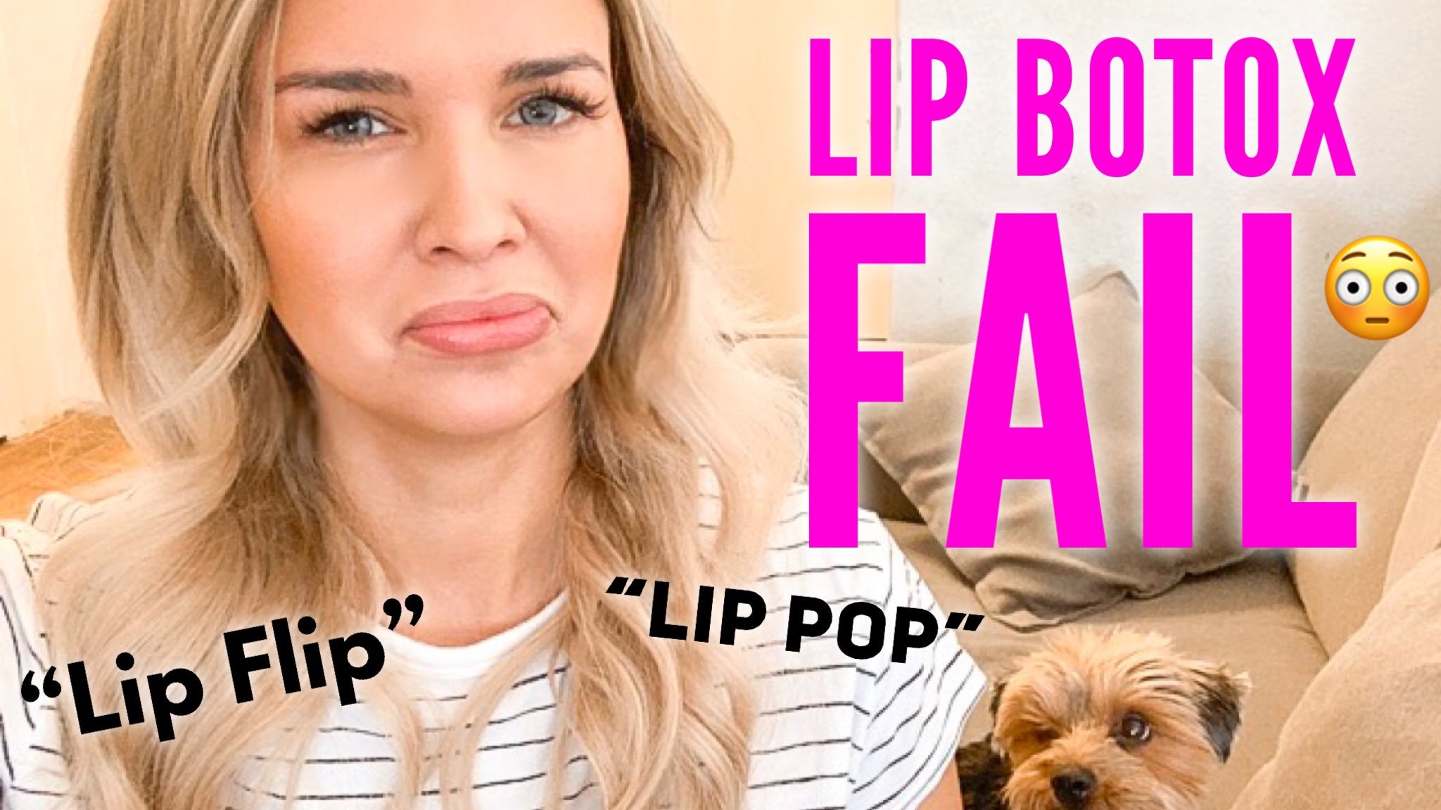 Botox Lips Gone Wrong