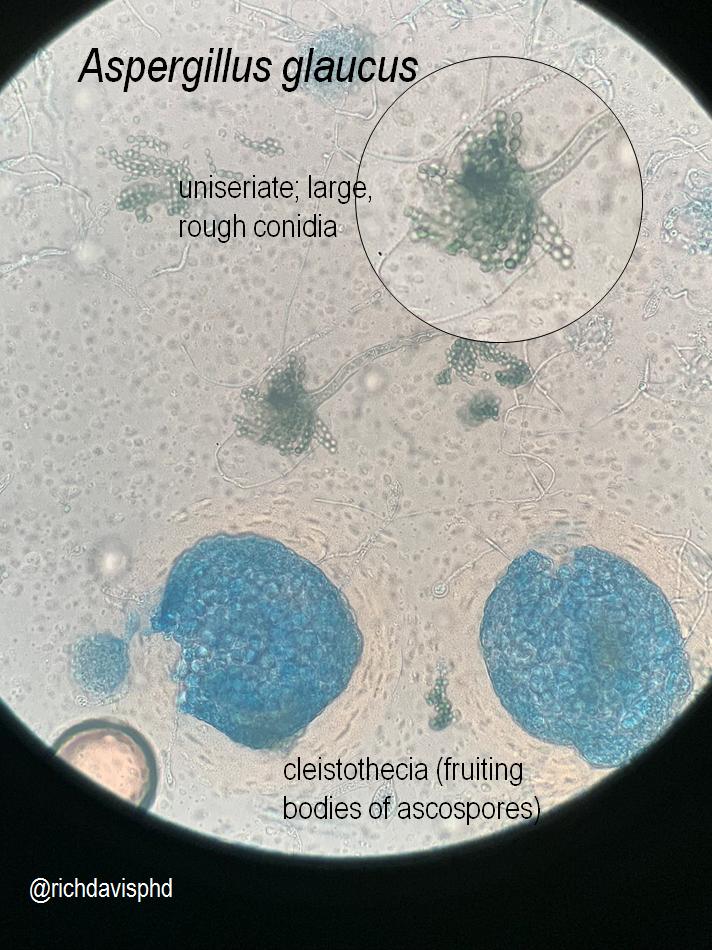 Aspergillus Ascospores