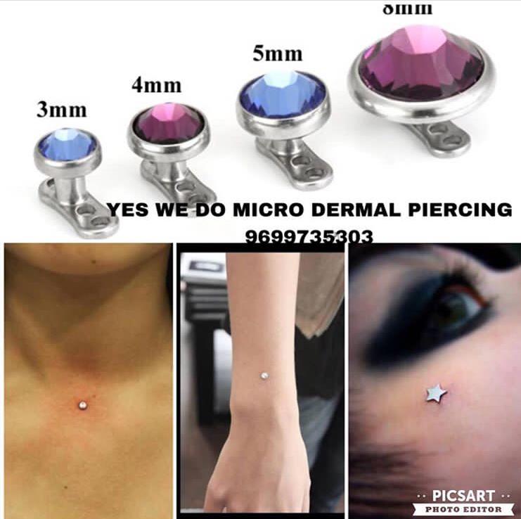 Dermal Piercing Removal