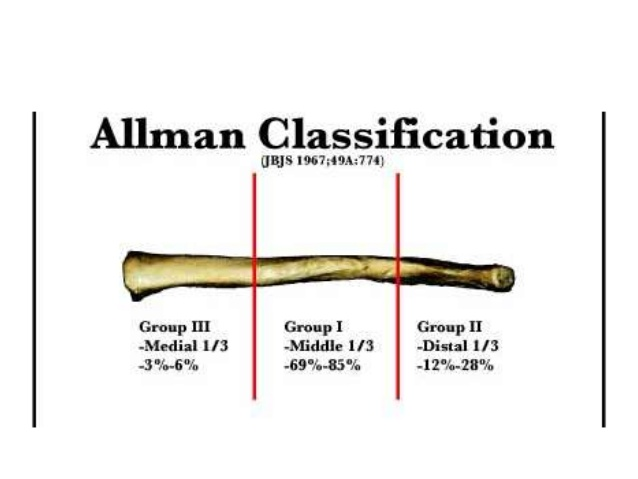 Clavicle Fracture Classification