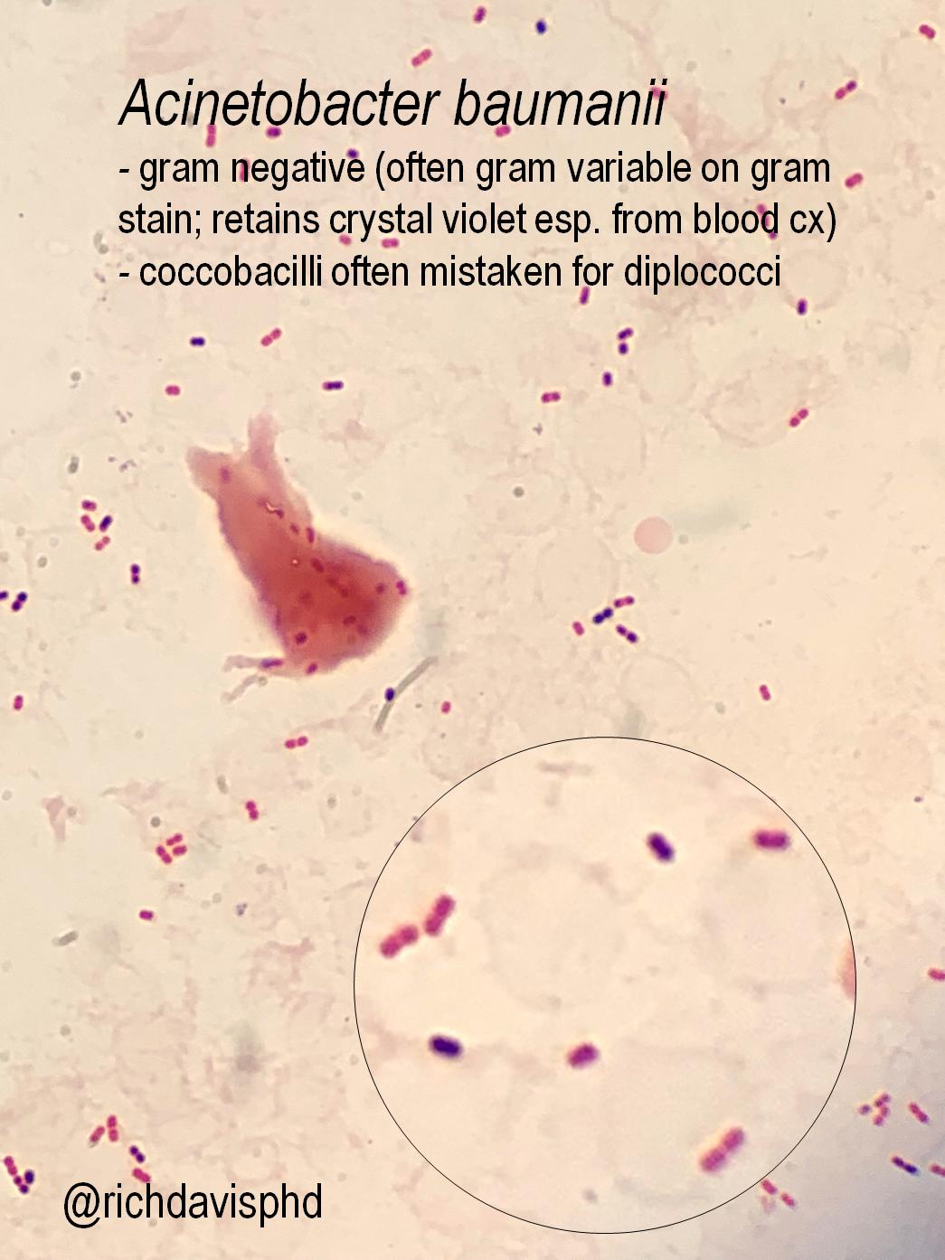 Gram Negative Coccobacilli