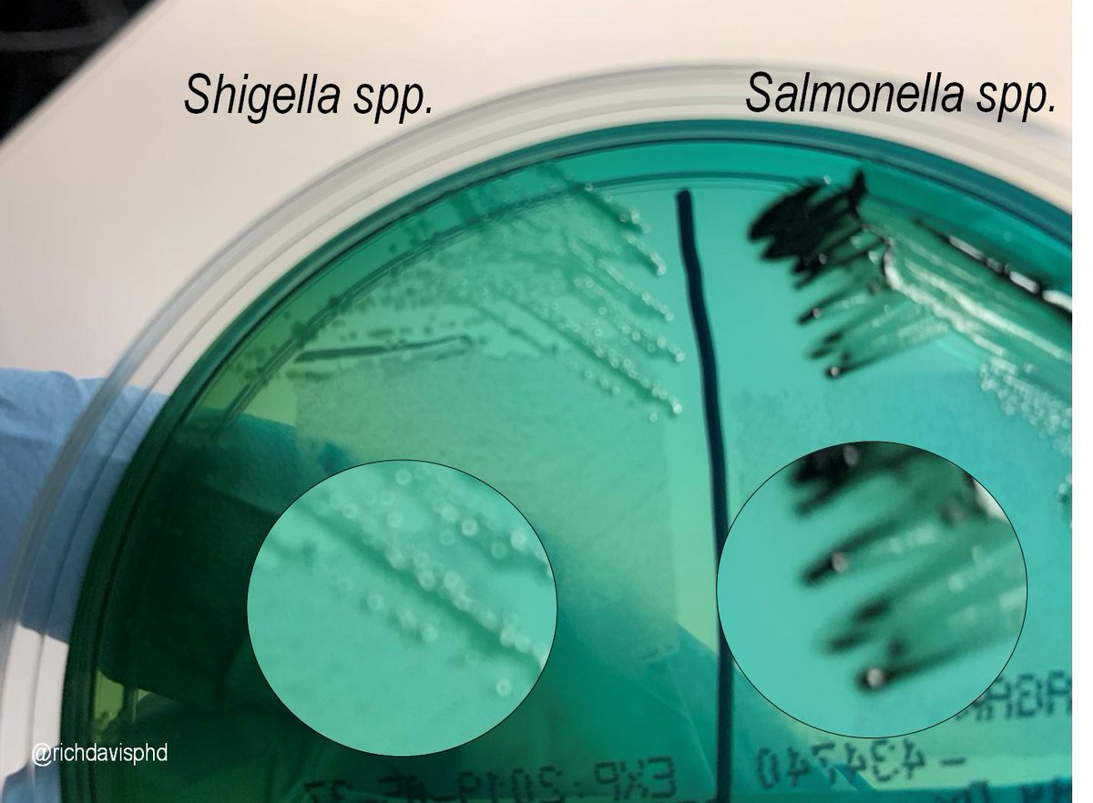 Hektoen Enteric Agar Salmonella