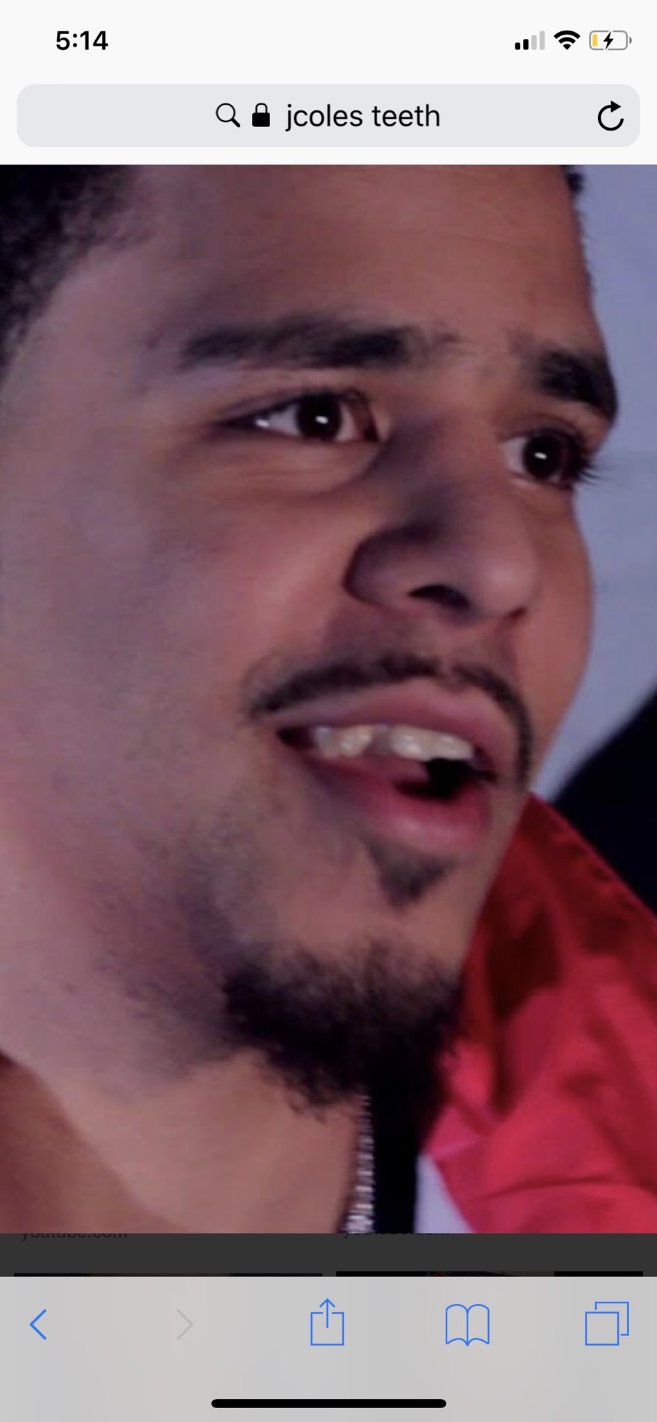 J Cole Teeth Close Up