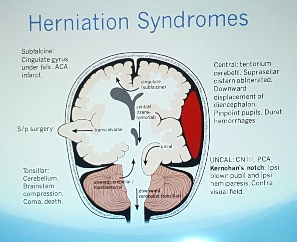 Central Herniation Syndrome