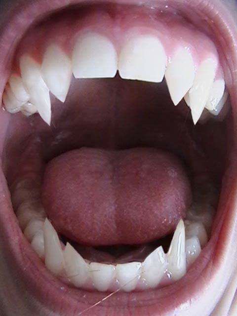 Sharpened Teeth Body Modification