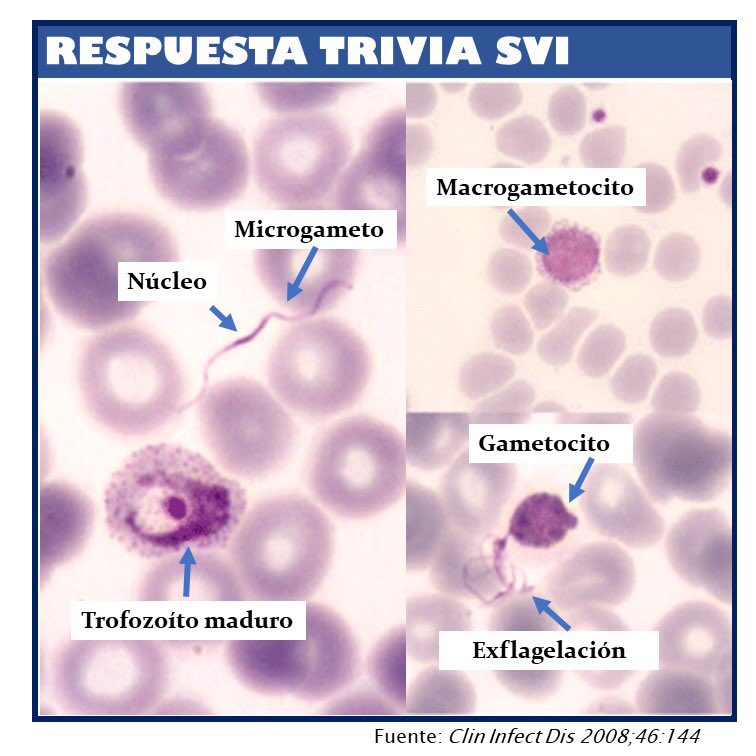 Microgametocito De Plasmodium Vivax