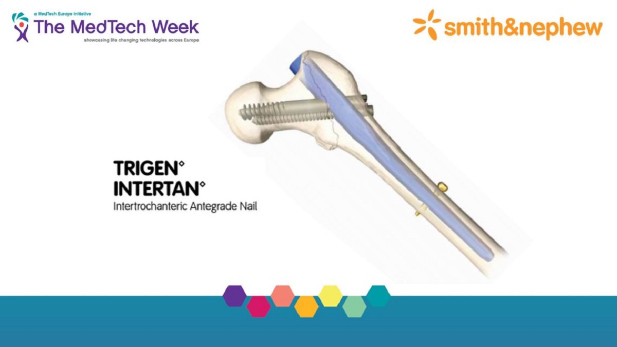 Smith Nephew Femoral Nail