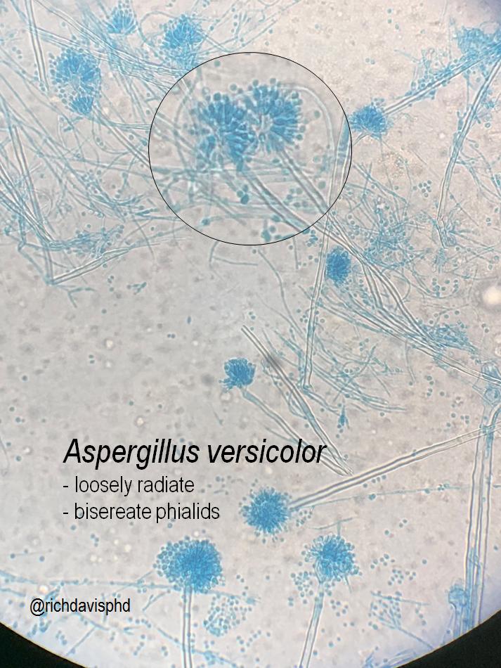 Aspergillus Versicolor Morphology