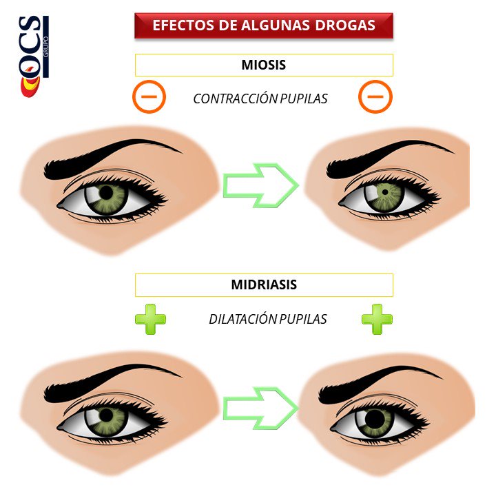 Miosis Y Midriasis