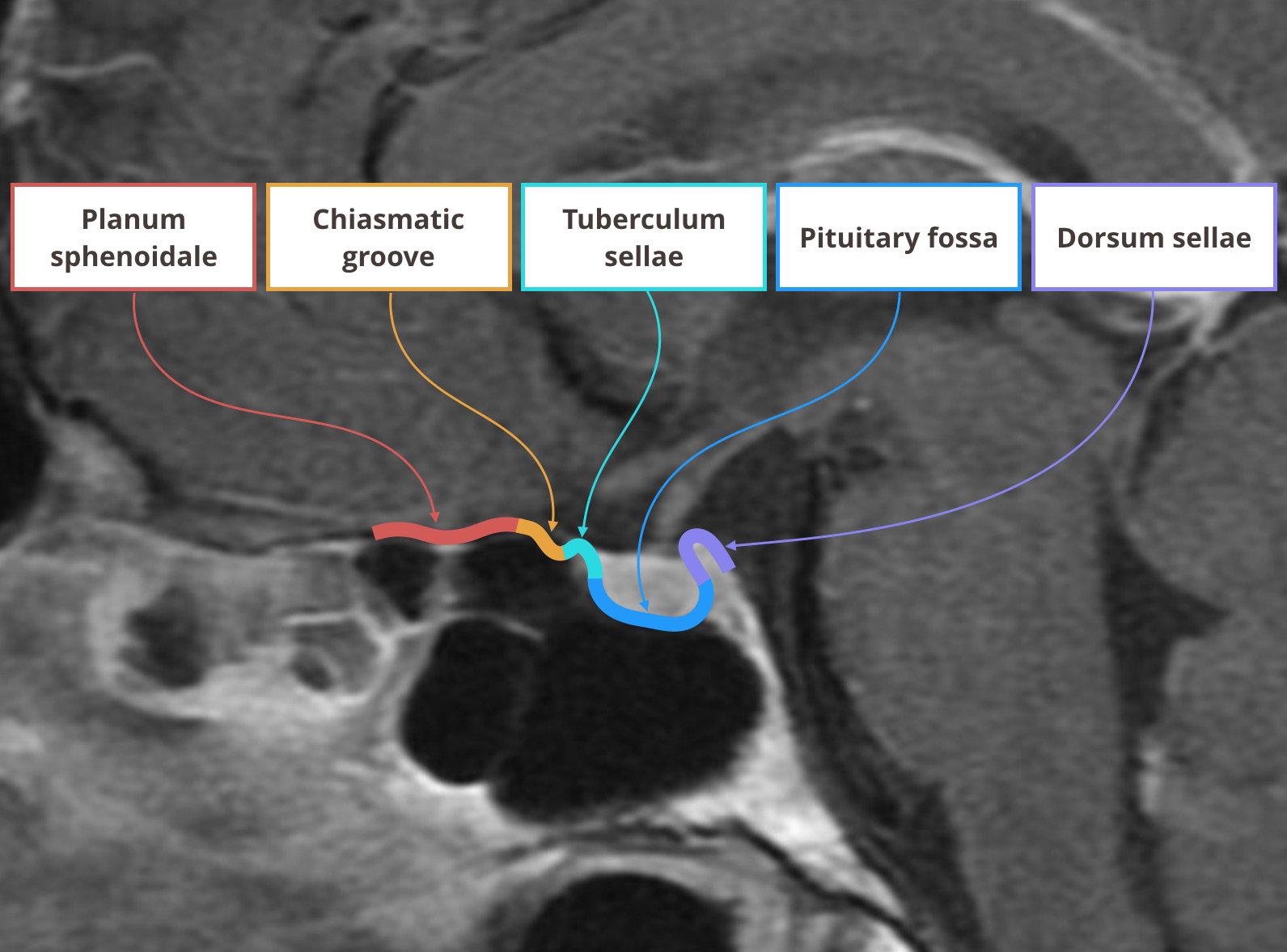 Planum Sphenoidale Anatomy
