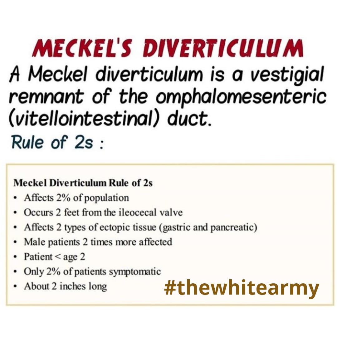 Meckels Diverticulum Rule Of 2