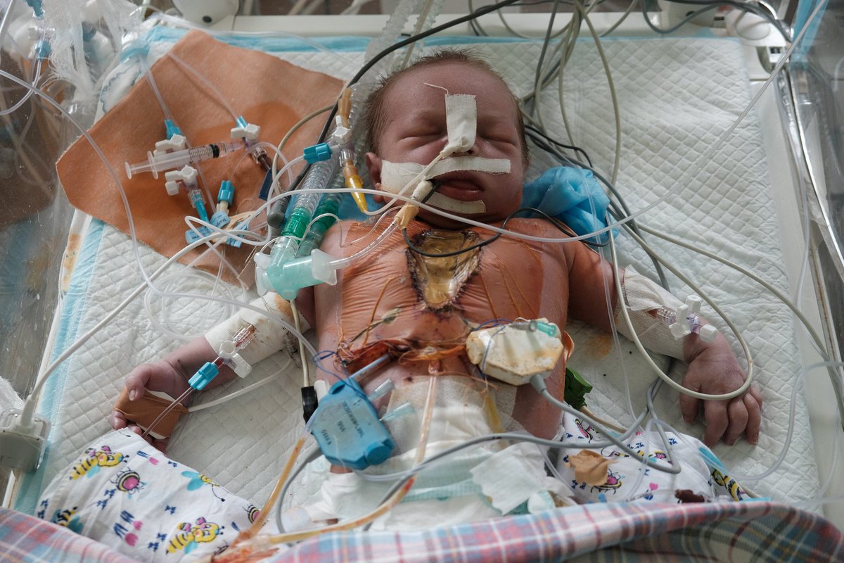 Chernobyl Side Effects Images