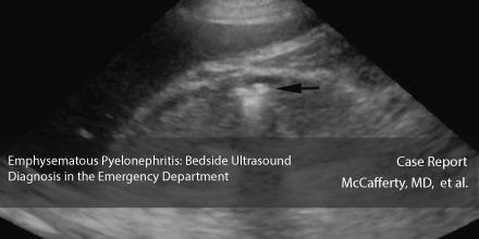 Emphysematous Pyelonephritis Ultrasound