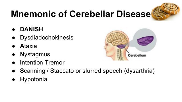 Cerebellar Signs Antrim ED Meducation cerebellar-signs-antrim-ed-meducation