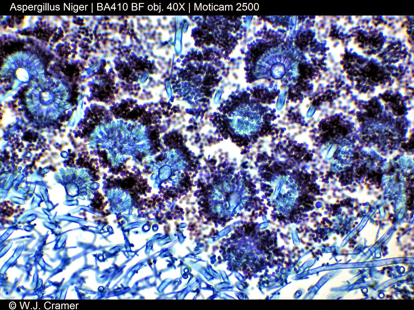 Aspergillus Under Microscope