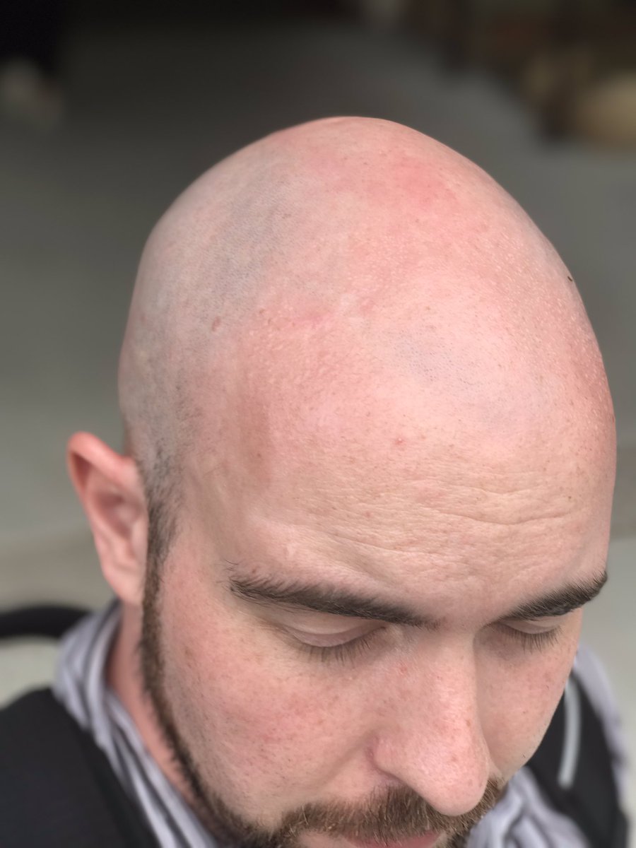 Farfromsubtle Fraser