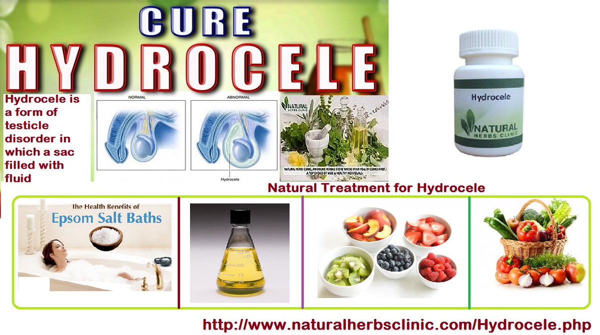 Hydrocele Treatment At Home