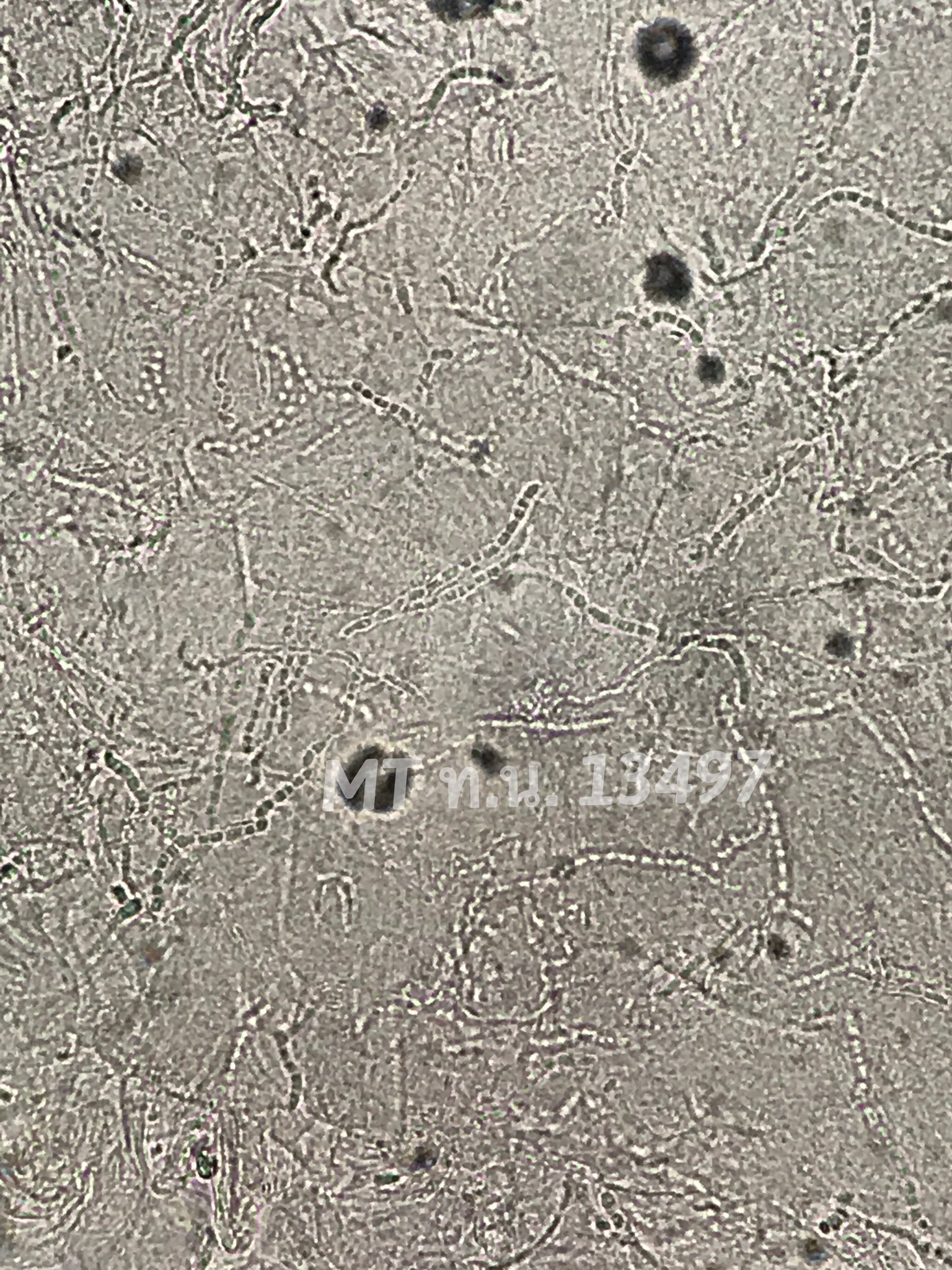 Arthroconidia