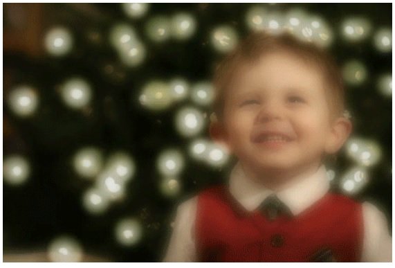 Cataract Vision Simulation