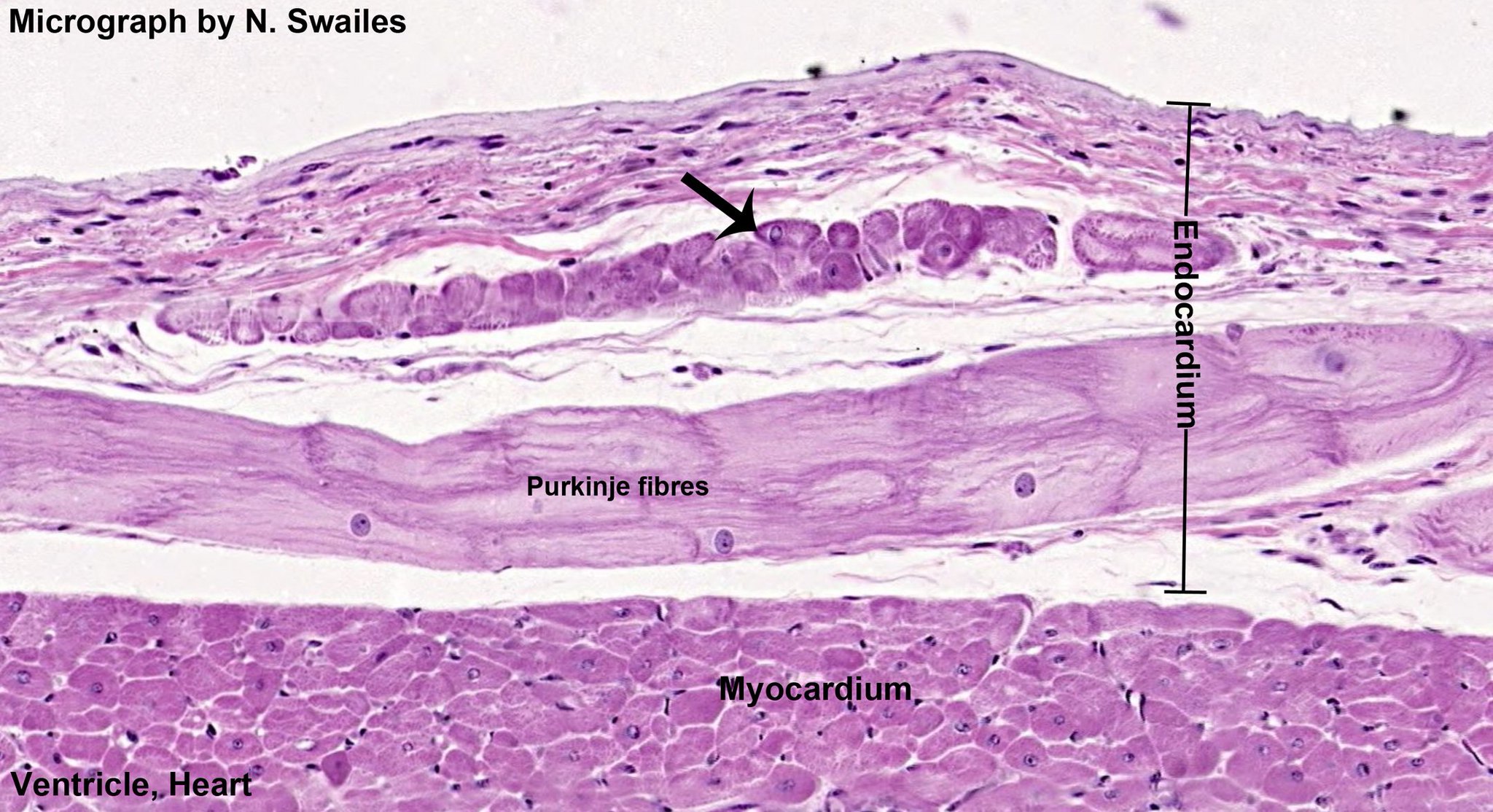 Purkinje Cells Heart
