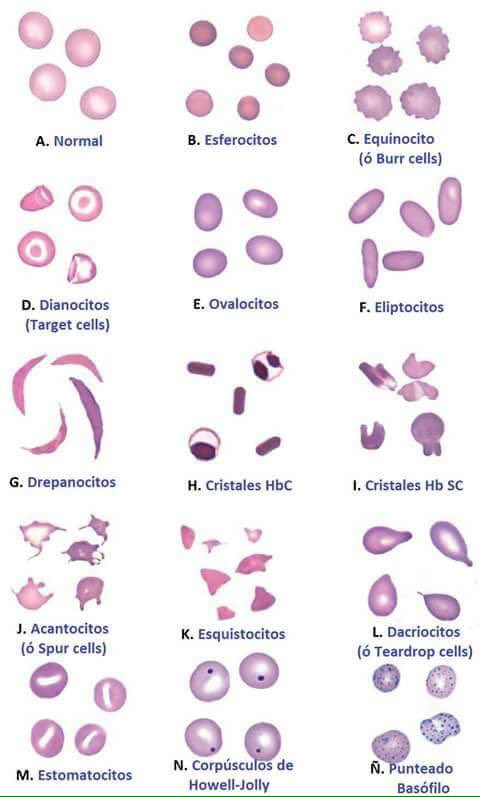 Alteraciones de los eritrocitos | PPT
