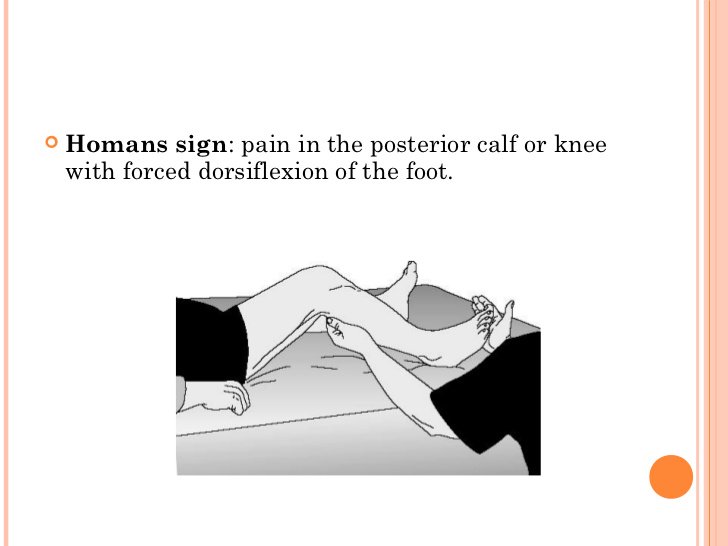 Homan Sign