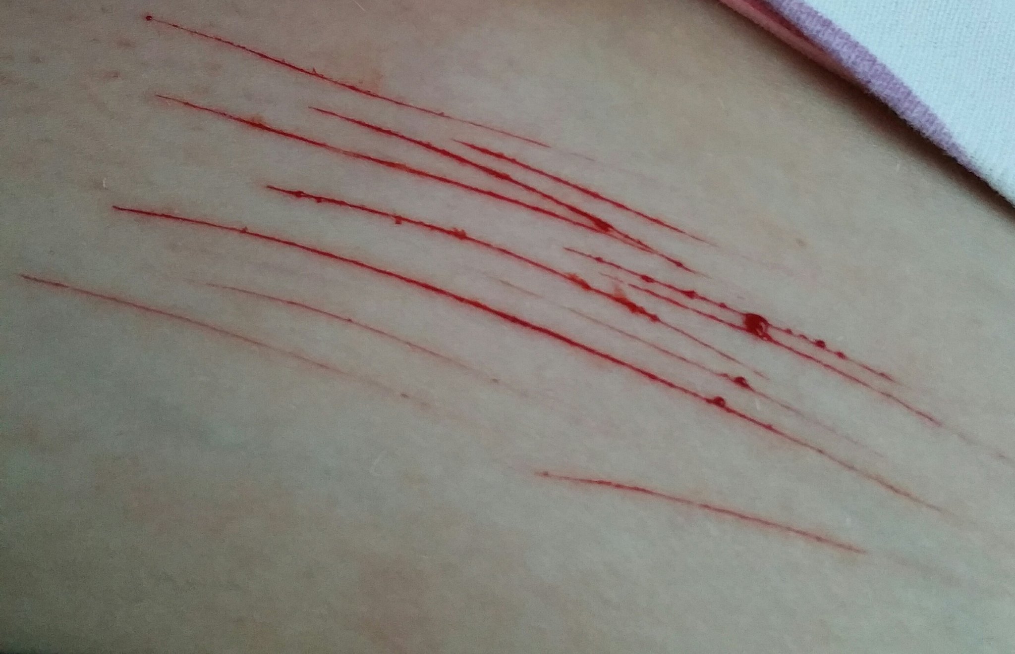 Love Arm Cuts