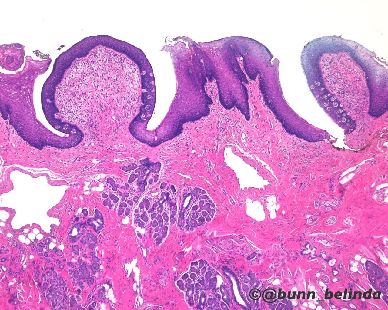 Circumvallate Papillae Histology