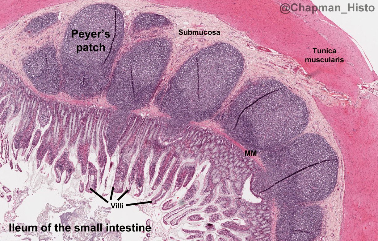 Peyers Patches Histology Labeled