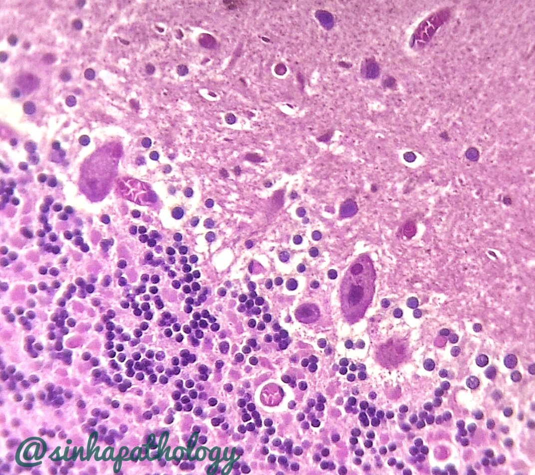 Negri Bodies