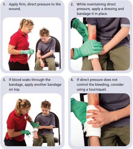 External Bleeding Treatment