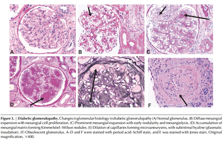 Mesangial Cell Histology