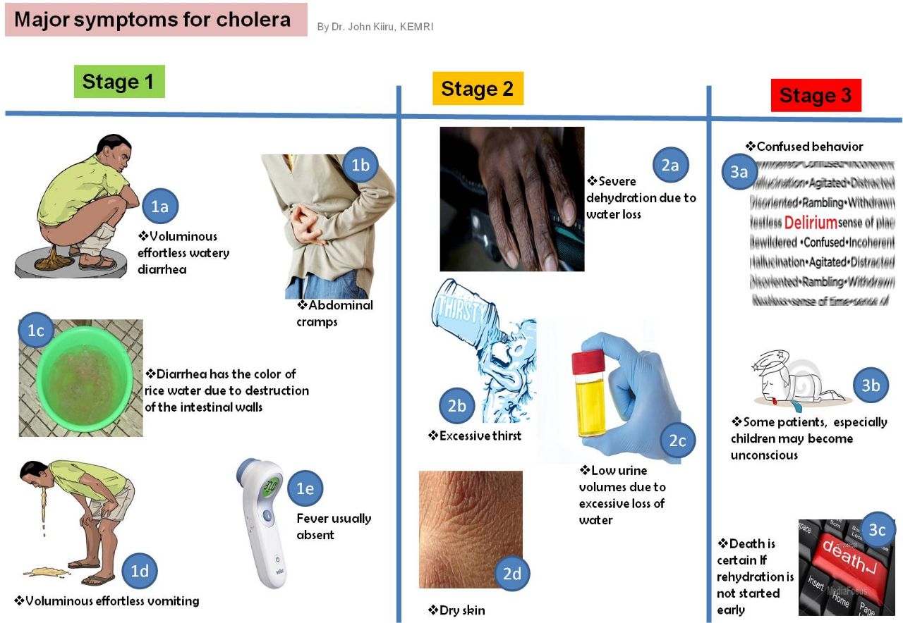 Cholera Symptoms And Signs
