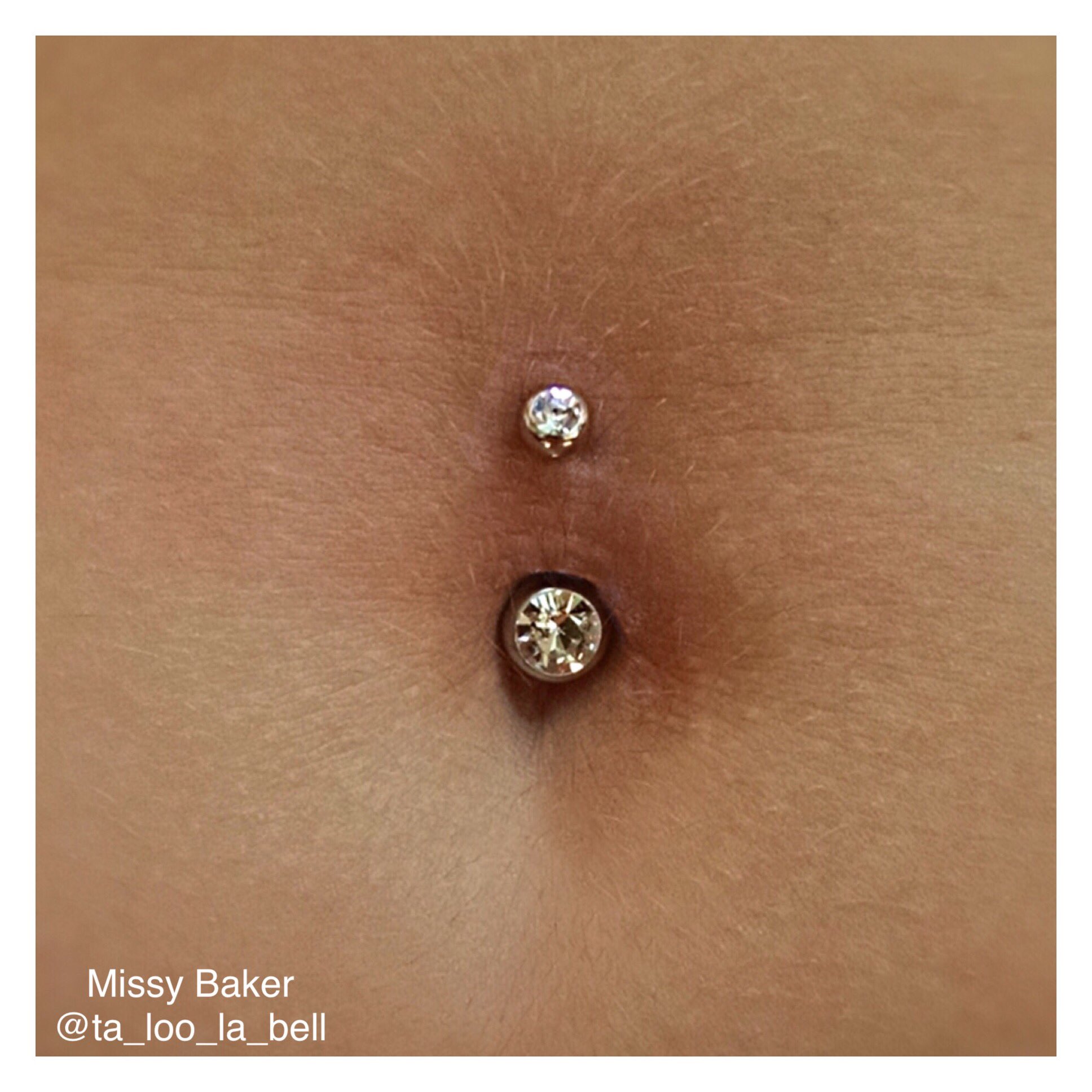 Bruised Belly Button Piercing