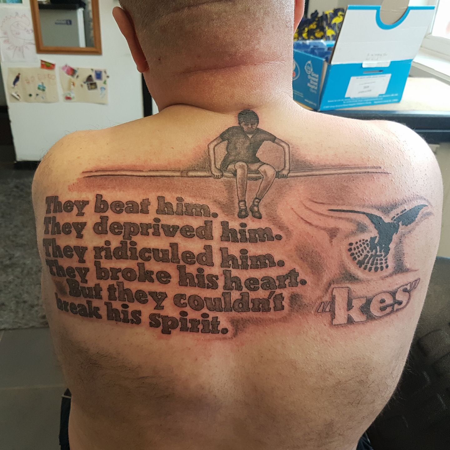 Kes Tattoos KES Newest Tattoo Removal Laser New Technology For Tattoo