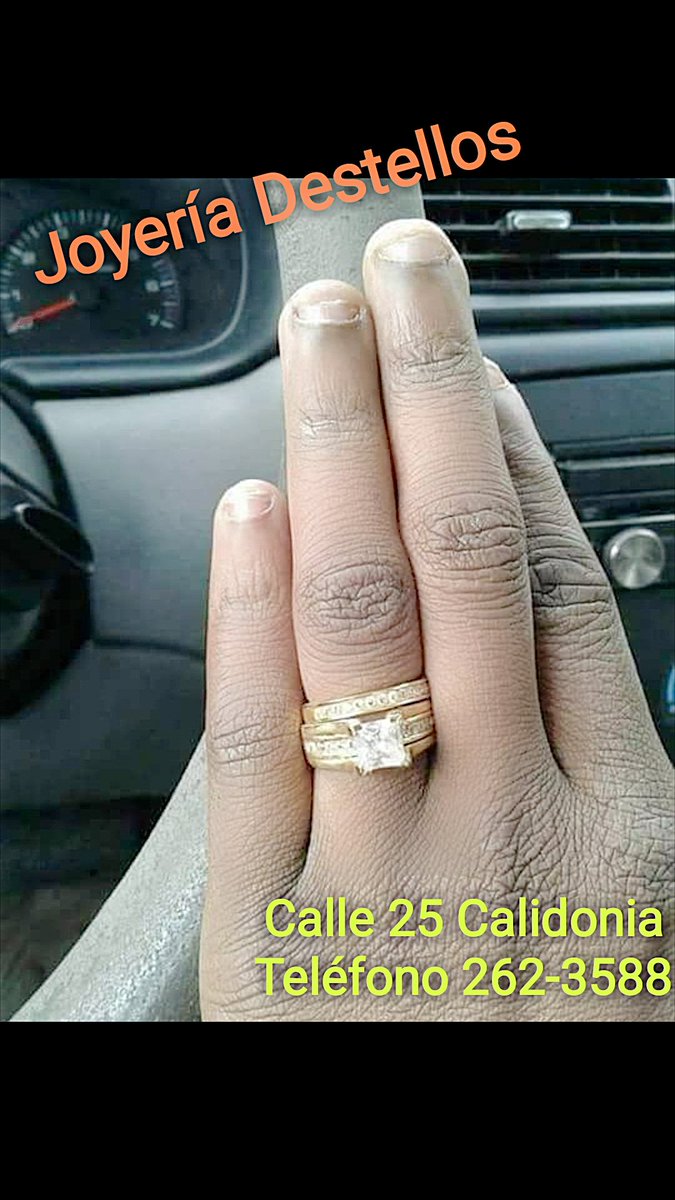 Pongamos fotos de manos feas - Forocoches