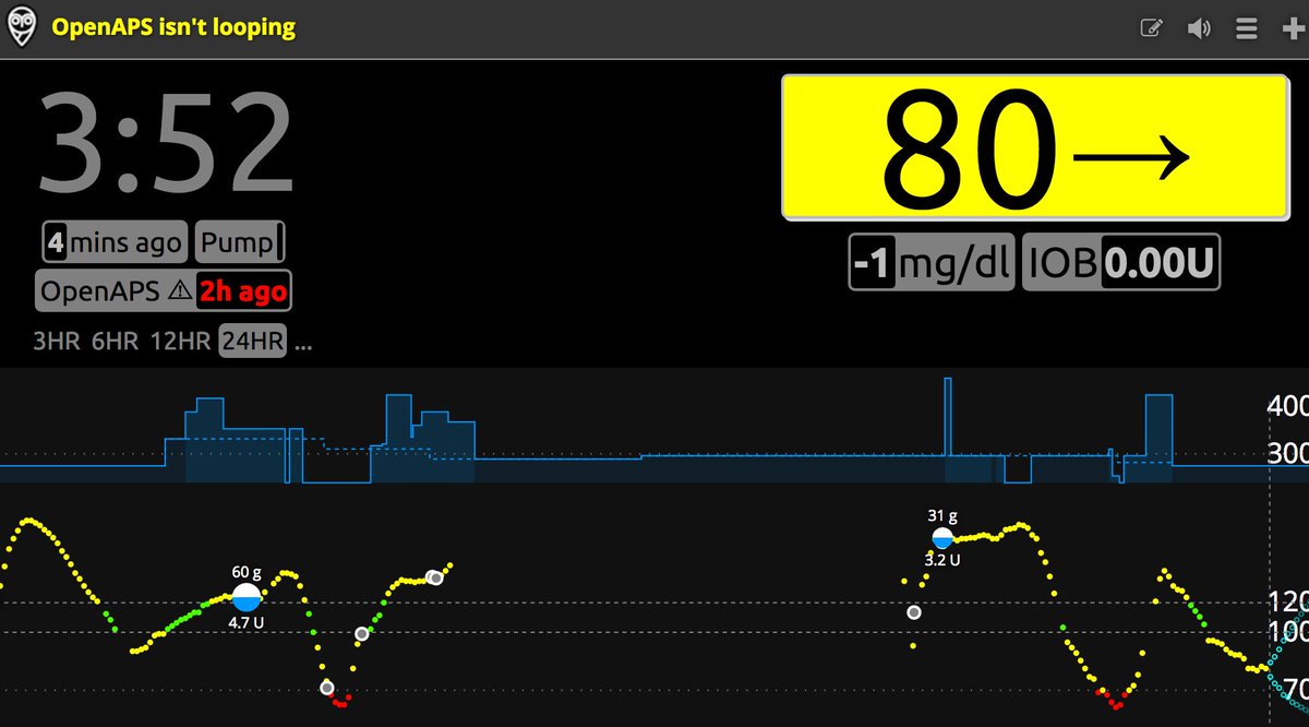 OpenAPS.org (@OpenAPS) | Twitter