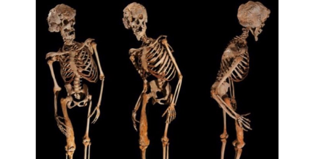 Joseph Carey Merrick, better known as the Elephant Man, was born ...