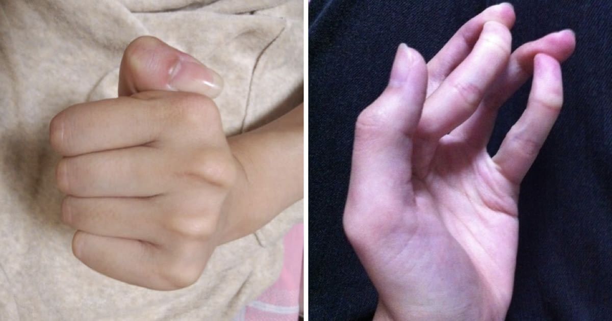 Impossible Pictures 9gag