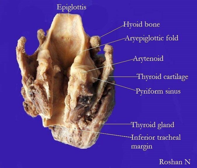 Total Laryngectomy Specimen